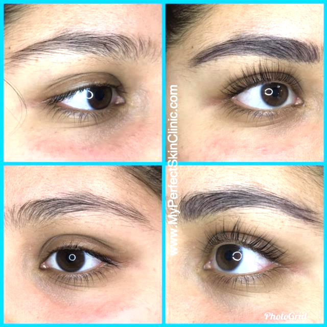 My Perfect Skin Clinic In Gilbert AZ | Vagaro